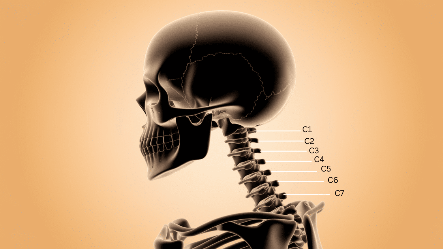 Cervicalgia Defined: Symptoms, and Treatments - Lotus Yoga Dallas