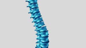 Thecal Sac Compression: A Complete Patient Guide - Lotus Yoga Dallas