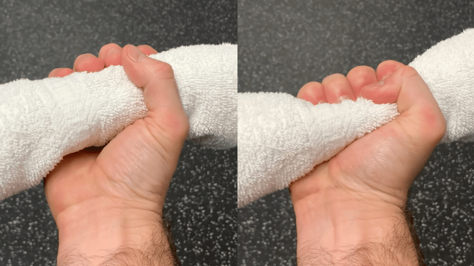 9 Trigger Finger Exercises and Treatments - Lotus Yoga Dallas
